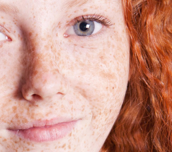 Surgical Dermatology - Radien Dermatology